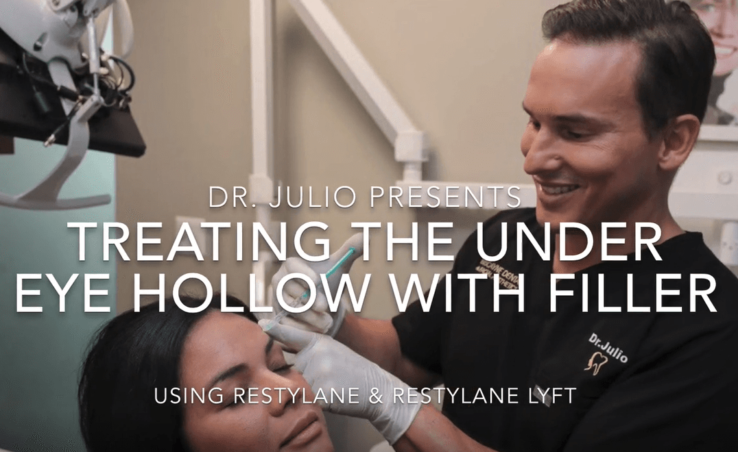 Video: Restylane Under Eye Filler